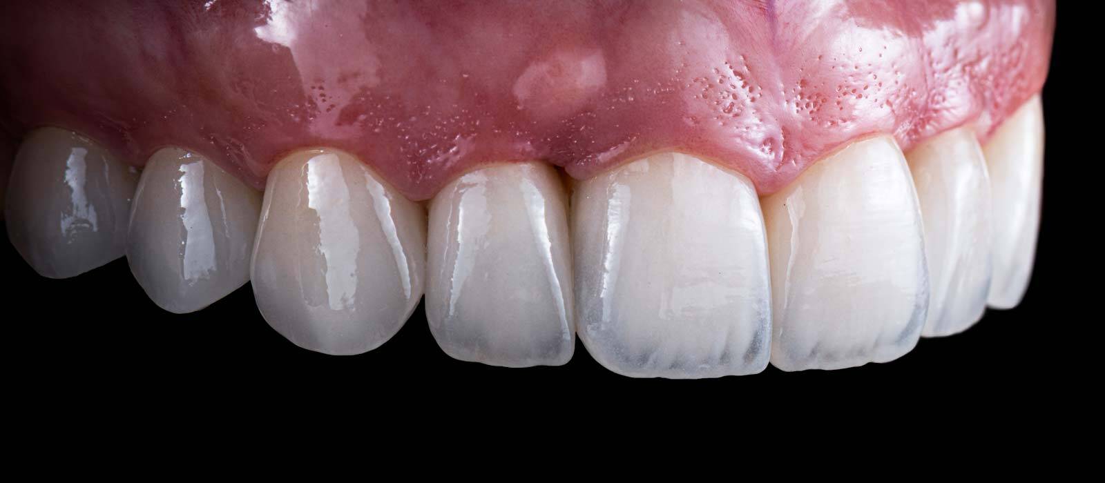 Smile Makeovers - Book A Free First Consultation For A Quote