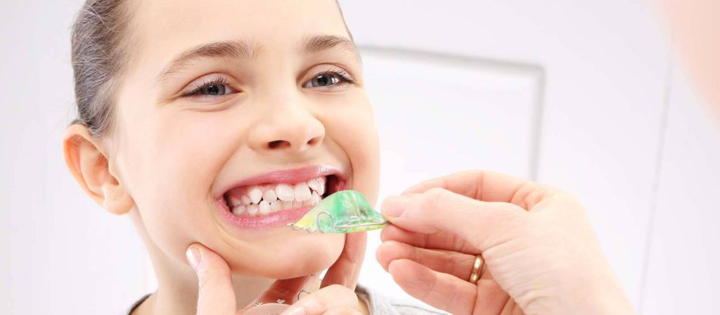 Oral Palatal Expanders - Dental Appliances - Orthodontics