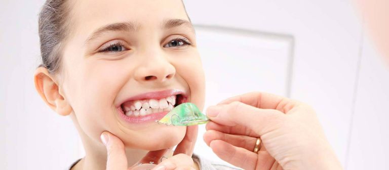 Oral Palatal Expanders - Dental Appliances - Orthodontics