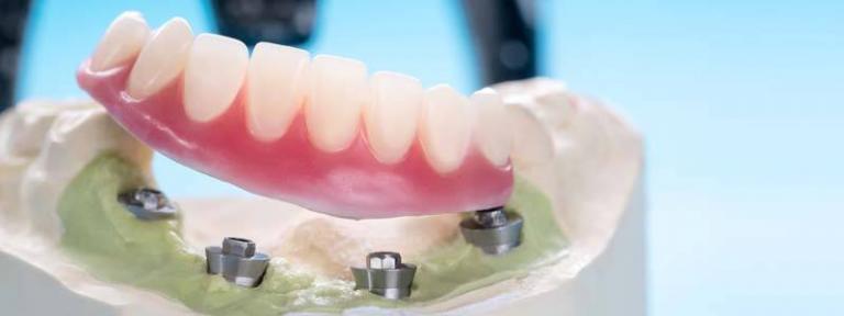 Dentures - Dental Teeth Replacement Denture Clinic Near Me
