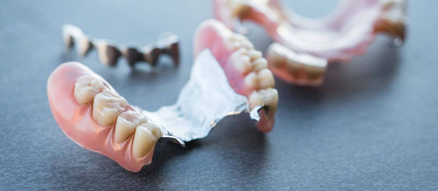 Partial Dentures - Flexible & Metal Denture - Amazing Smiles