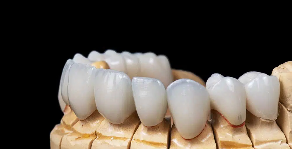 Full Mouth Rehabilitation & Reconstruction - Cosmetic Dental